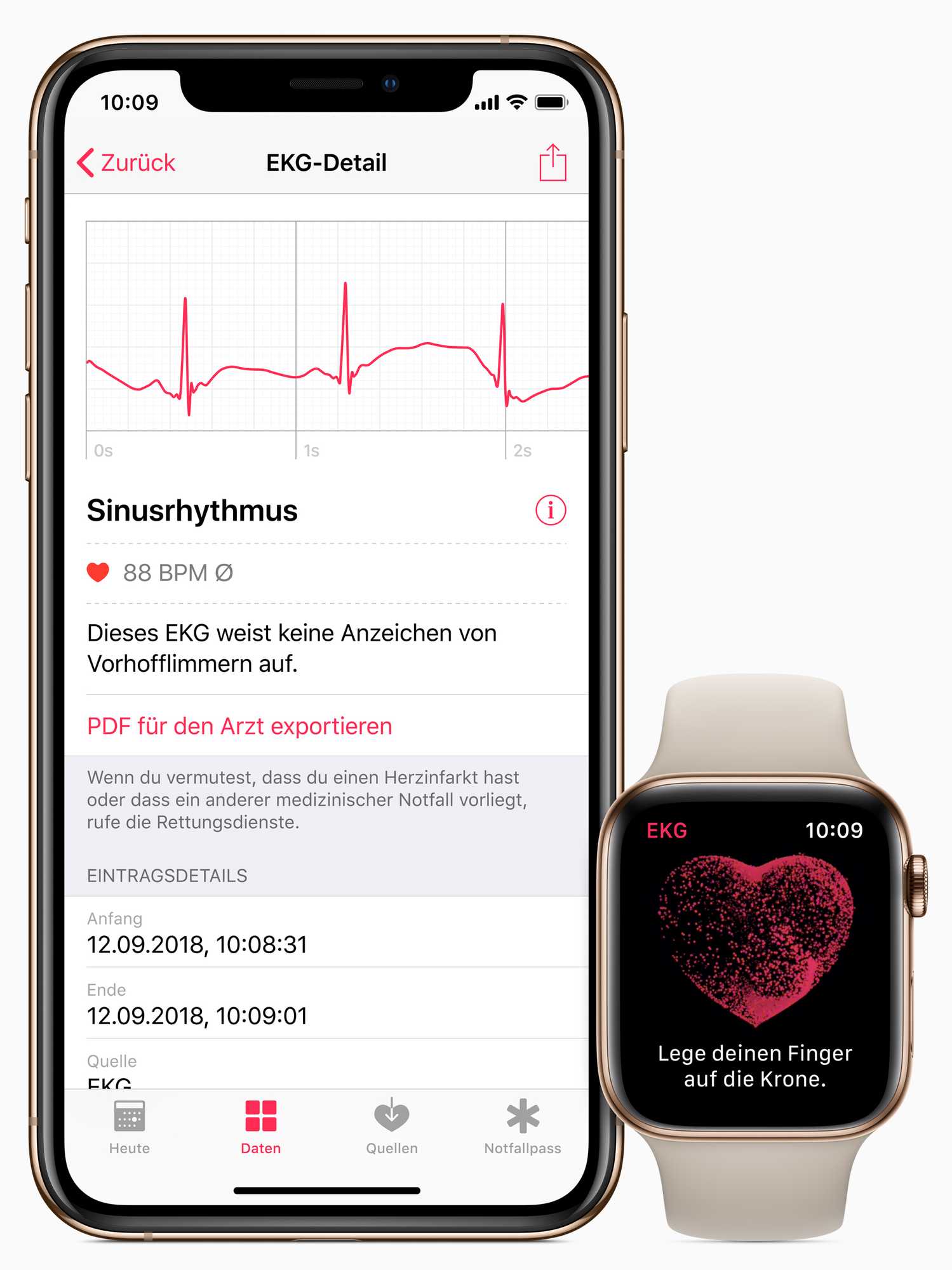 EKG-App auf der Apple Watch verfügbar